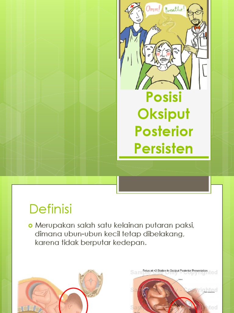 Posisi Oksiput Posterior Persisten | PDF | Sains & Matematika