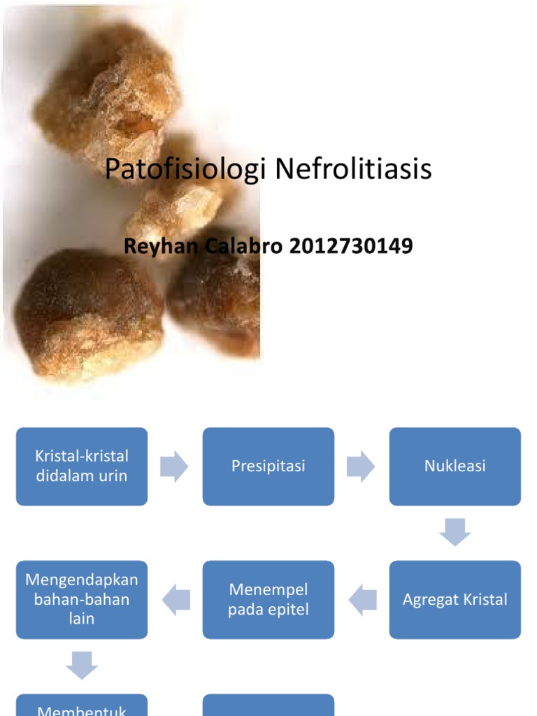 Patofisiologi Nefrolitiasis | PDF