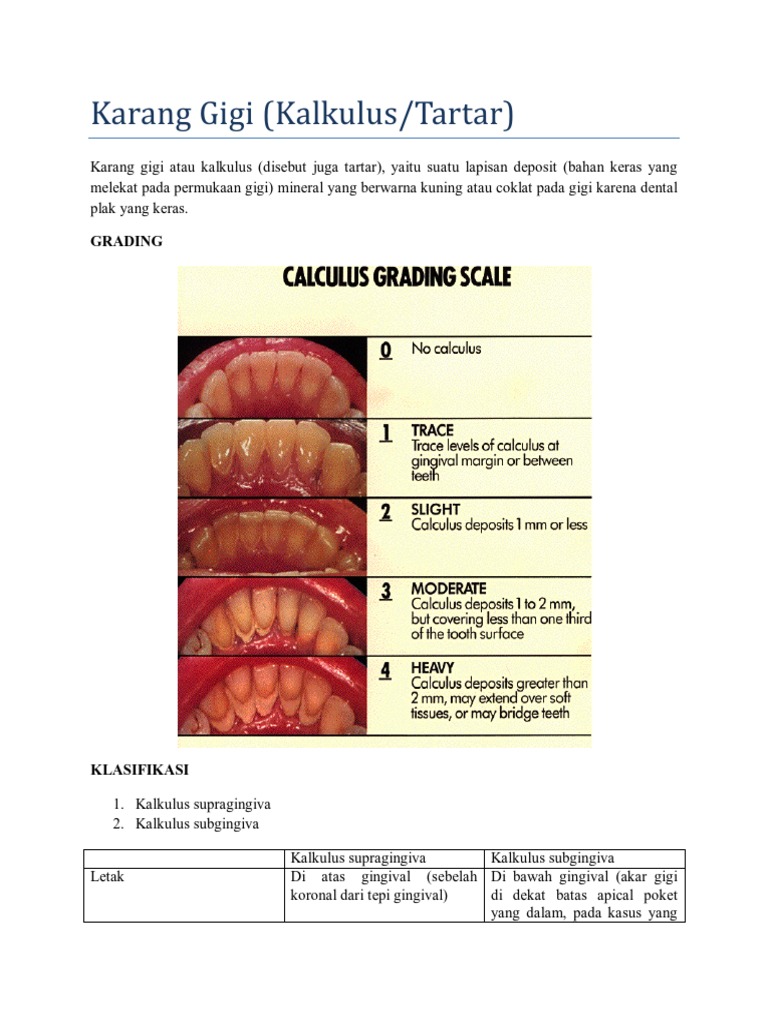 Karang Gigi Calculus | PDF