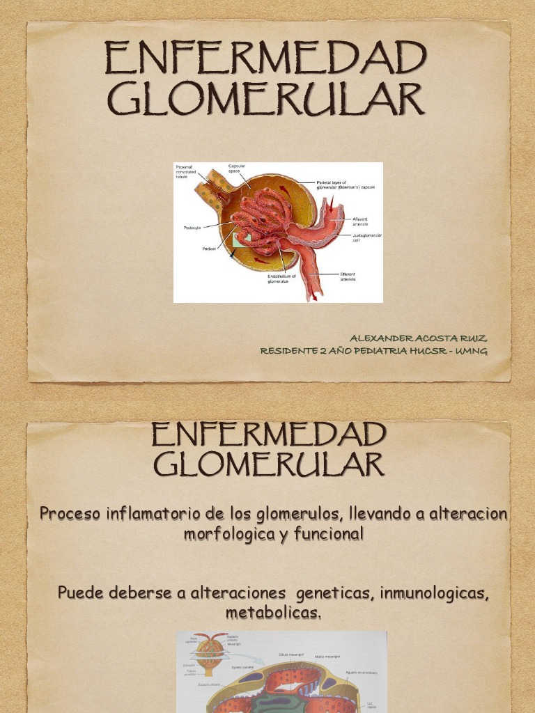 Enfermedad Glomerular | PDF | Especialidades Medicas | Medicina CLINICA