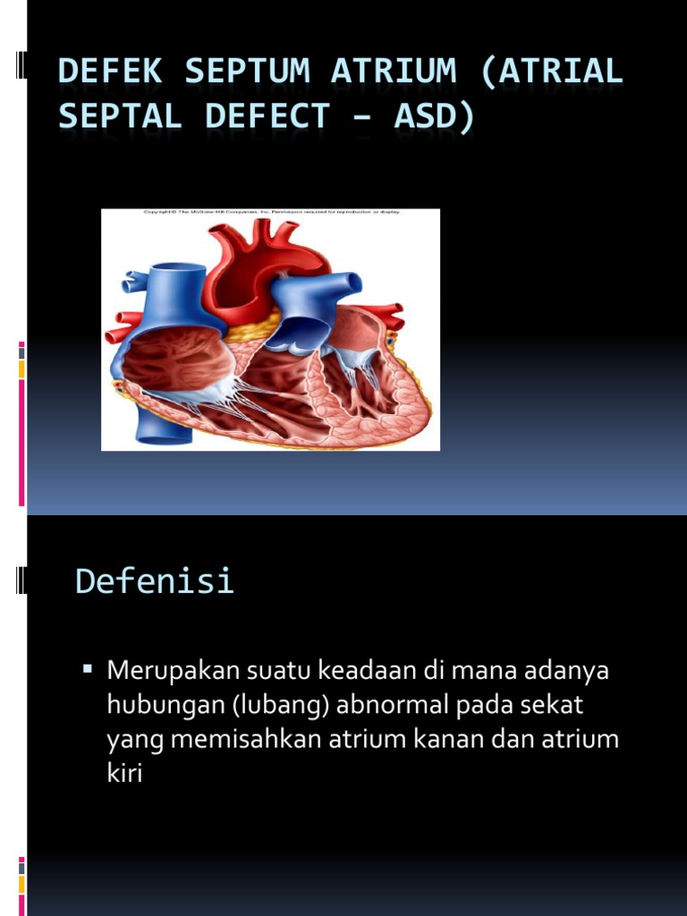 Defek Septum Atrium (Atrial Septal Defect | PDF