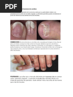 Onicectomía: Procedimiento y Cuidados | PDF | Clavo (anatomía) | Dedo ...