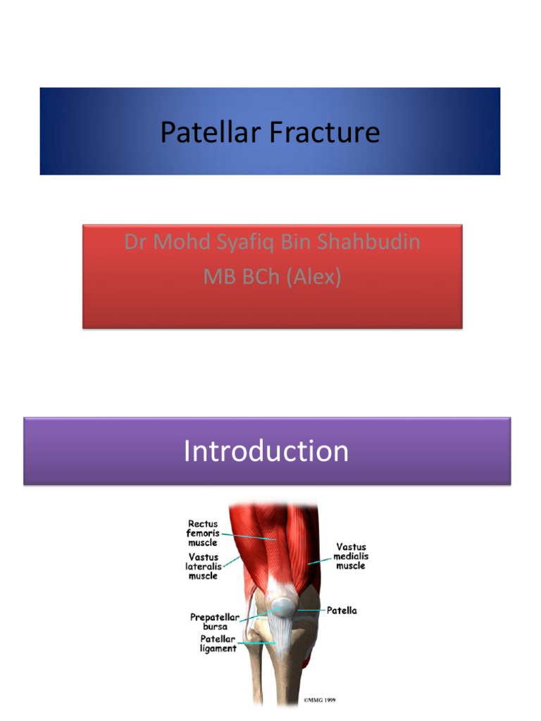 Patellar Fracture | PDF | Knee | Musculoskeletal System