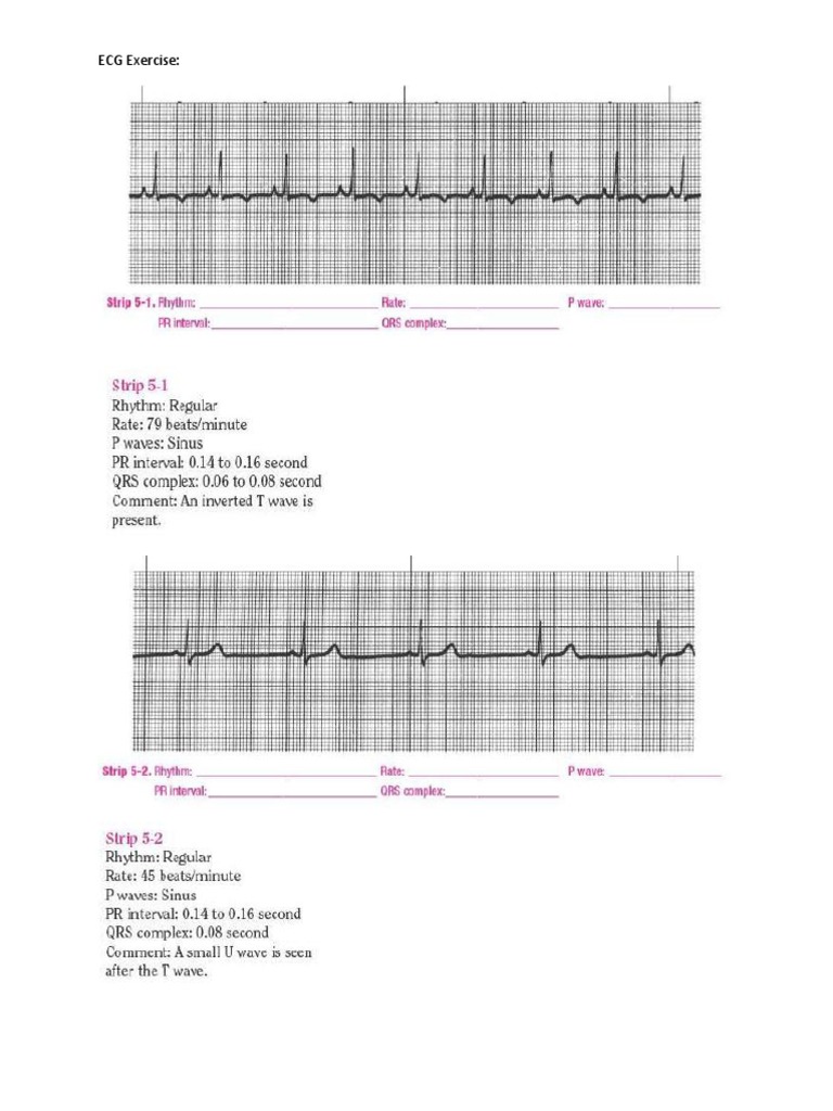 ECG Practice | PDF