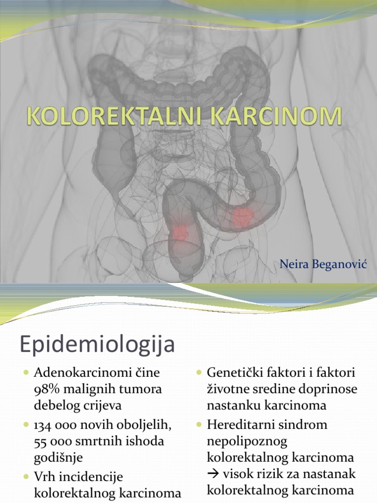 Kolorektalni Karcinom | PDF
