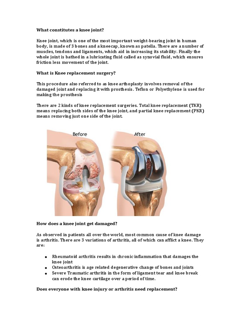 What Constitutes A Knee Joint | PDF | Knee | Osteoarthritis