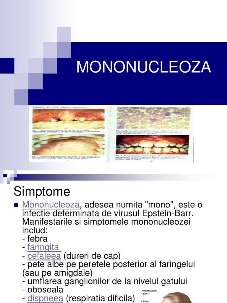 MONONUCLEOZA | PDF