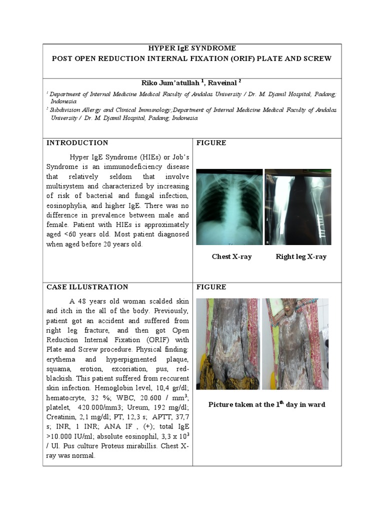 Poster Hyper Ige Syndrome | PDF | Medicine | Diseases And Disorders