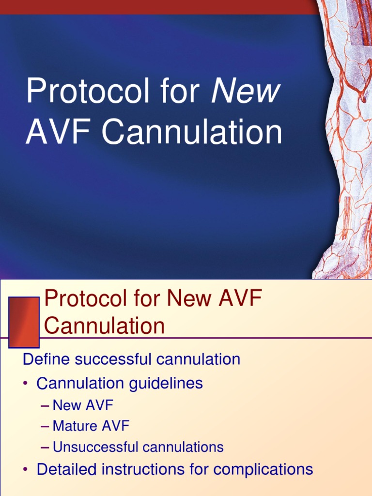 Cannulation of The AVF Ch3 | PDF | Hemodialysis | Hemodynamics