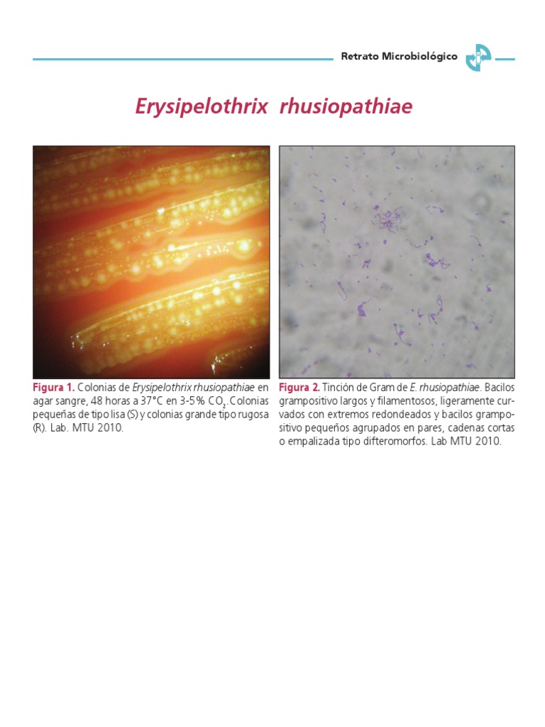 Erysipelothrix | Microorganismo | Patología