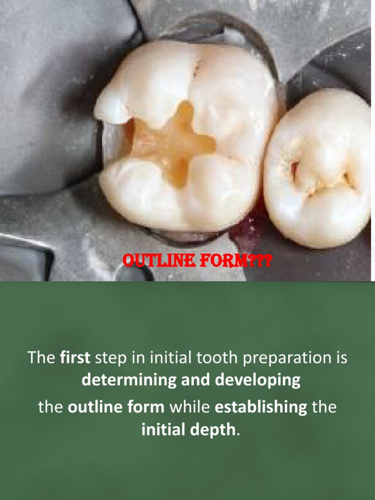 Outline Form | PDF | Tooth Enamel | Dentin