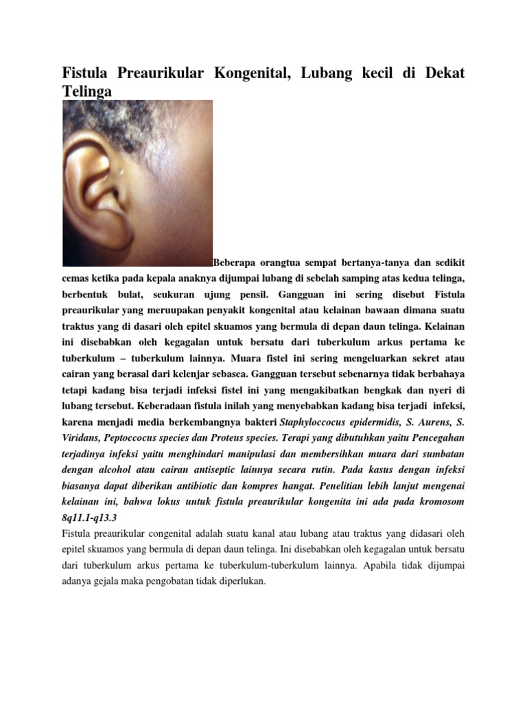 Fistula Preaurikular: Penjelasan dan Penanganan | PDF