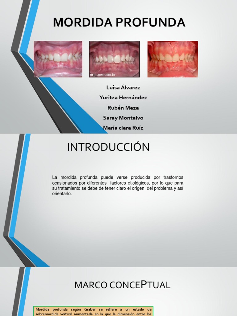 Mordida Profunda Final | Diente humano | Boca | Prueba gratuita de 30 ...