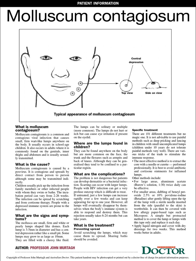 Molluscum Contagiosum | PDF | Infection | Clinical Medicine