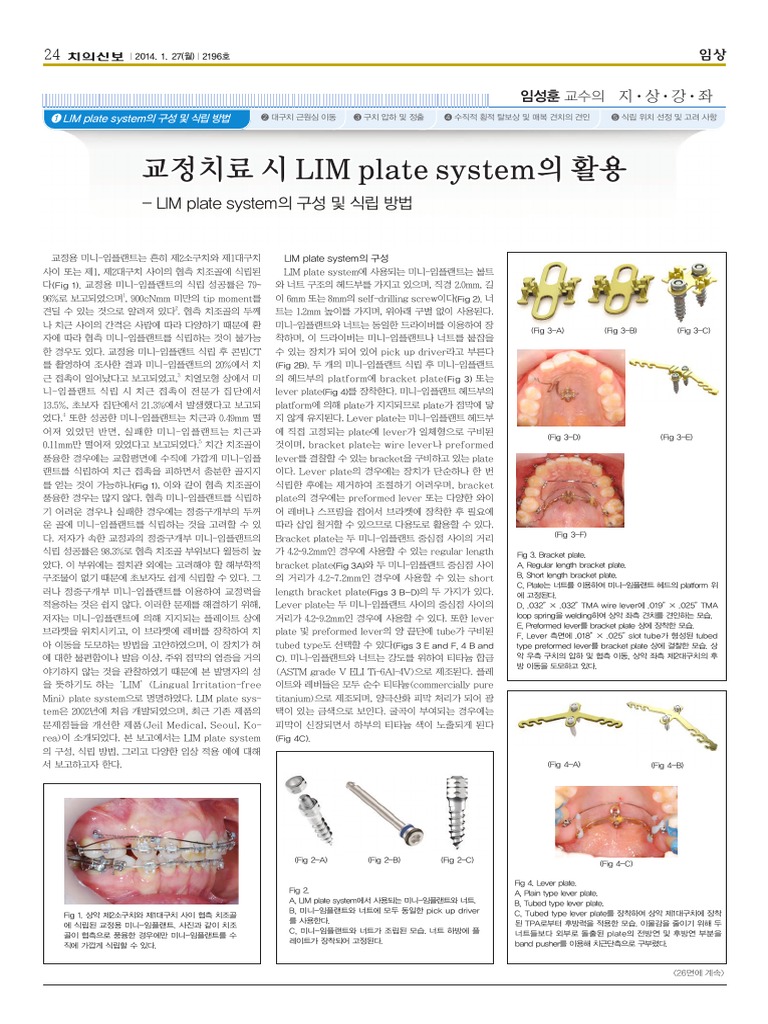 Lim Plate System | PDF
