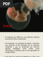 Sindrome de Torch | PDF | Especialidades Medicas | Enfermedades y ...