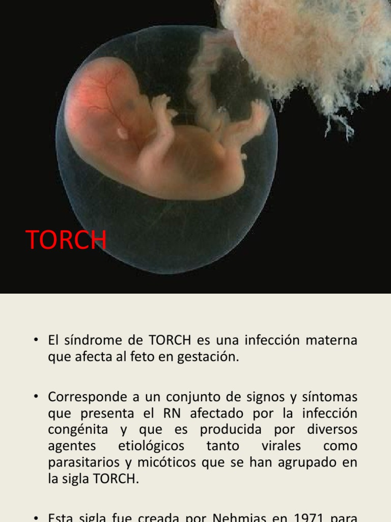 Infecciones TORCH en el embarazo | PDF | Medicina | Microbiología