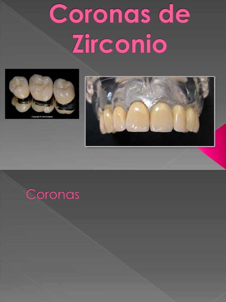 Coronas de Zirconio | PDF | Implante dental | Dentadura postiza
