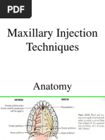 Maxillary Dental Injection Techniques | PDF | Dentistry | Dentistry ...