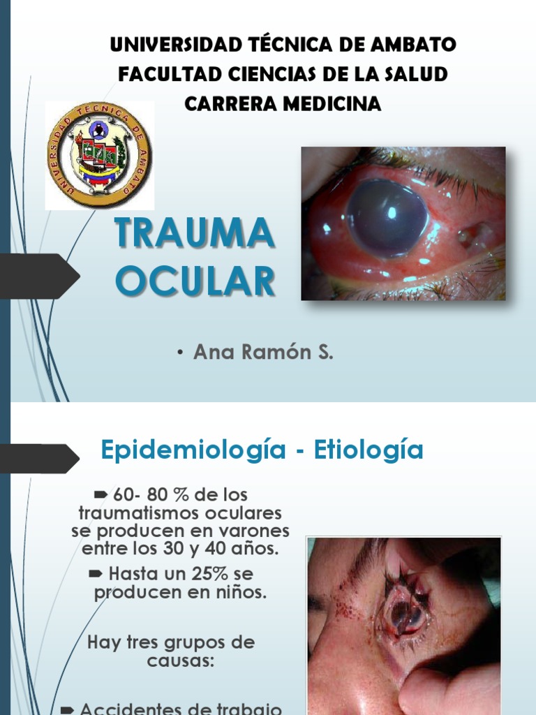 Trauma Ocular | PDF | Lesión | Ojo