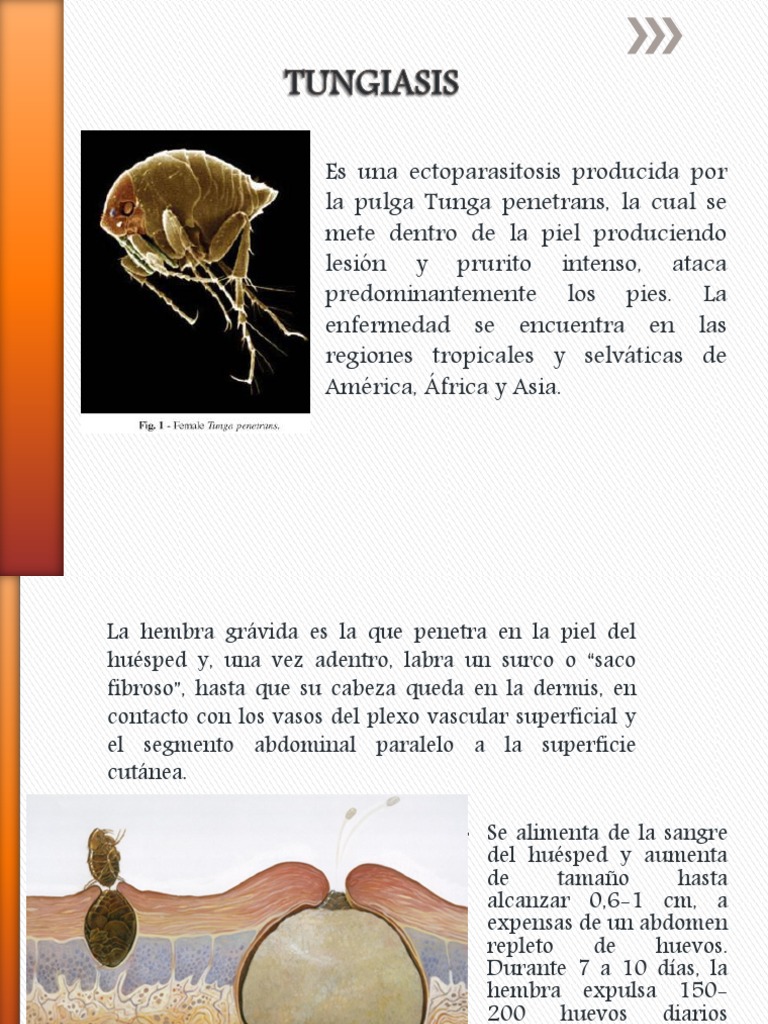 Tungiasis - Niguas | PDF | Medicina | Medicina CLINICA