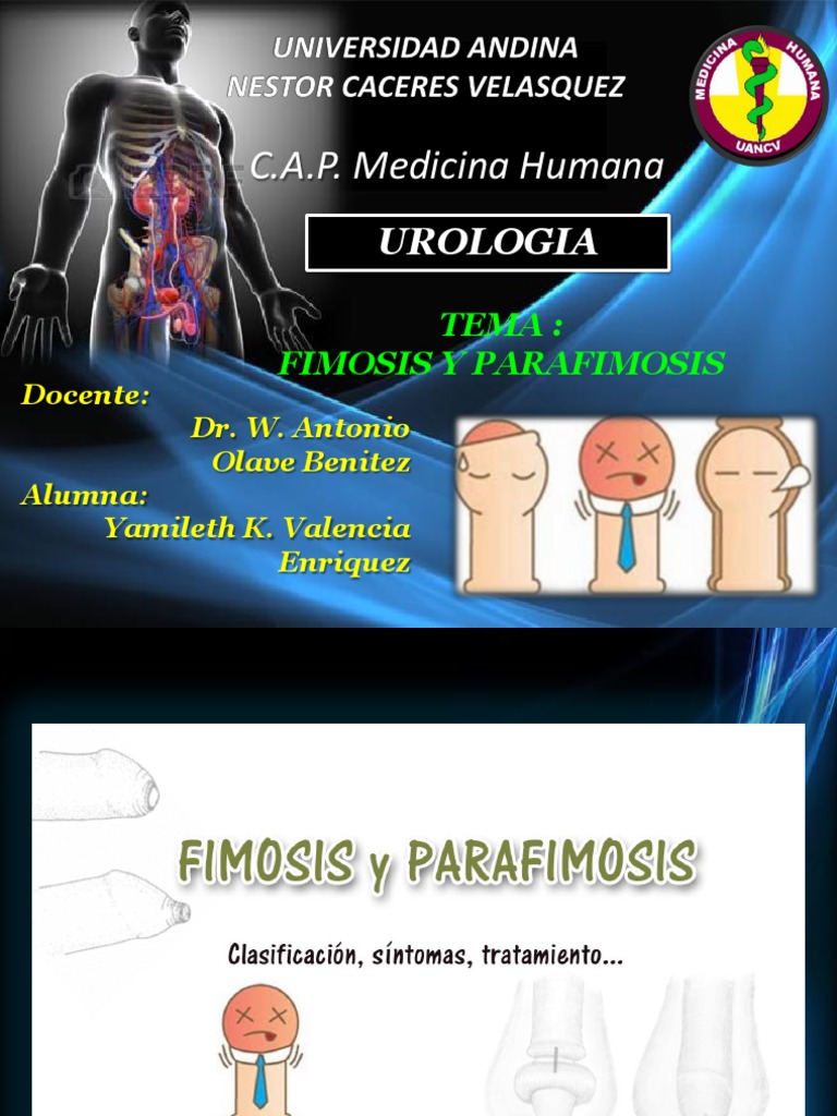 Fimosis y Parafimosis | PDF | Pene | Sistema Reproductor Mamífero