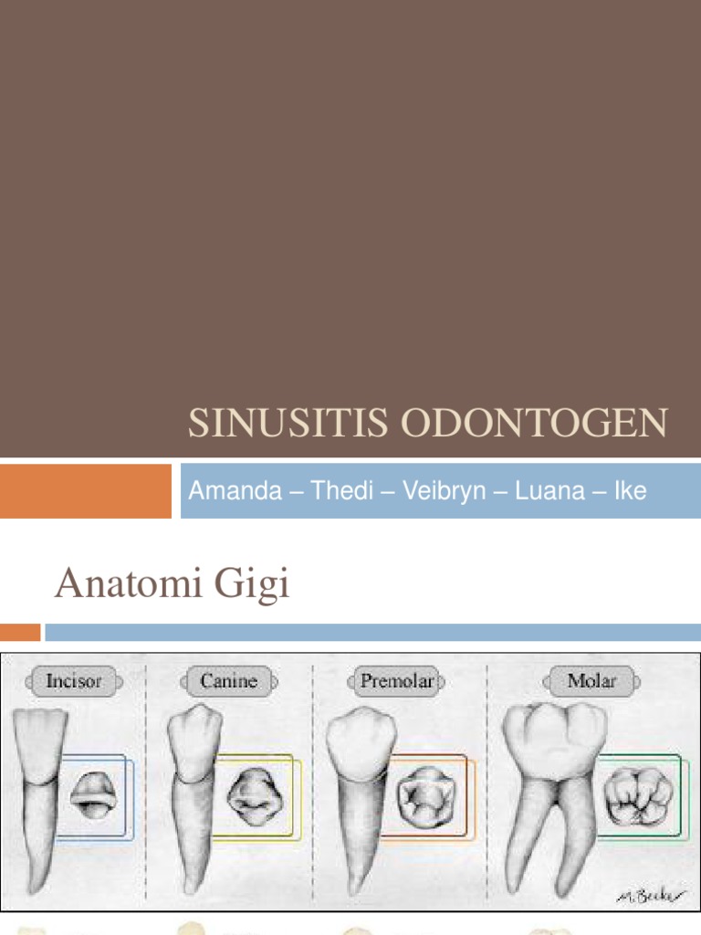 Sinusitis Dentogen | PDF