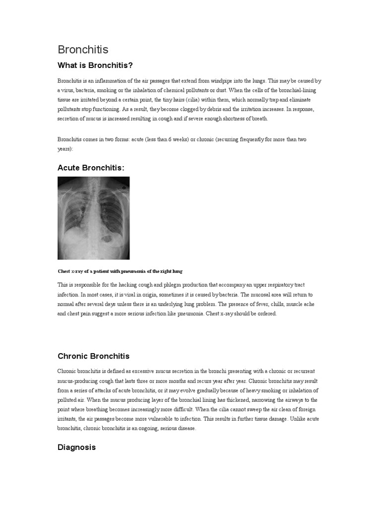 What Is Bronchitis? | Download Free PDF | Bronchitis | Mucus