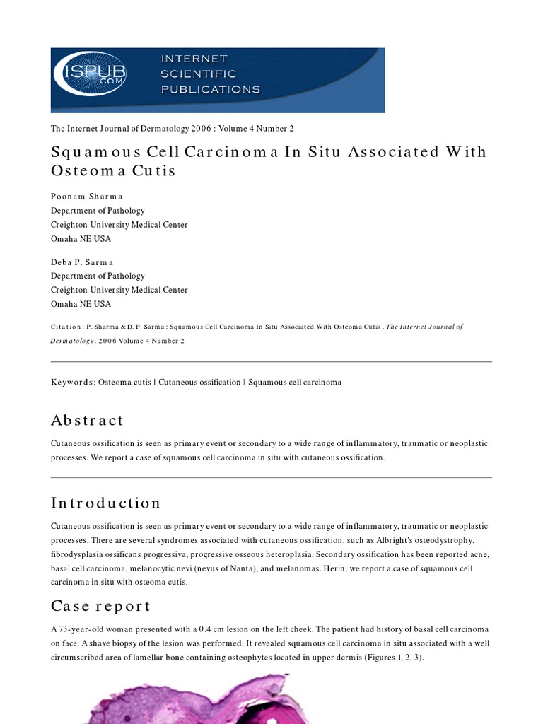 Squamous Cell Carcinoma in Situ Associated With Osteoma Cutis - The ...