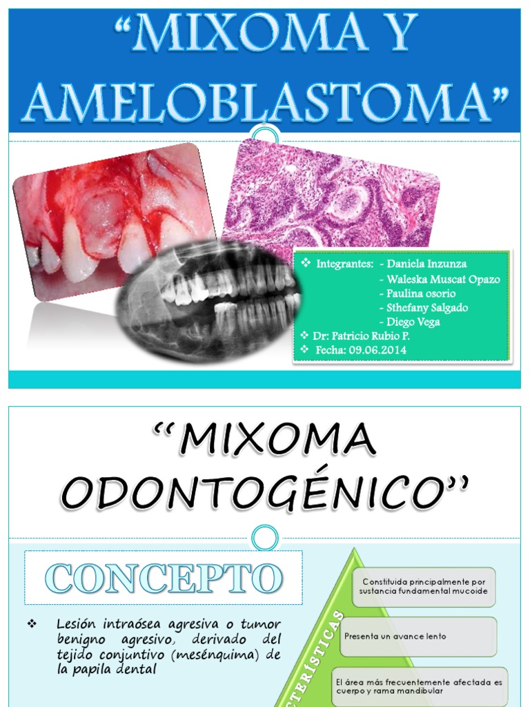 Mixoma y Ameloblastoma | PDF | Anatomía | Especialidades Medicas