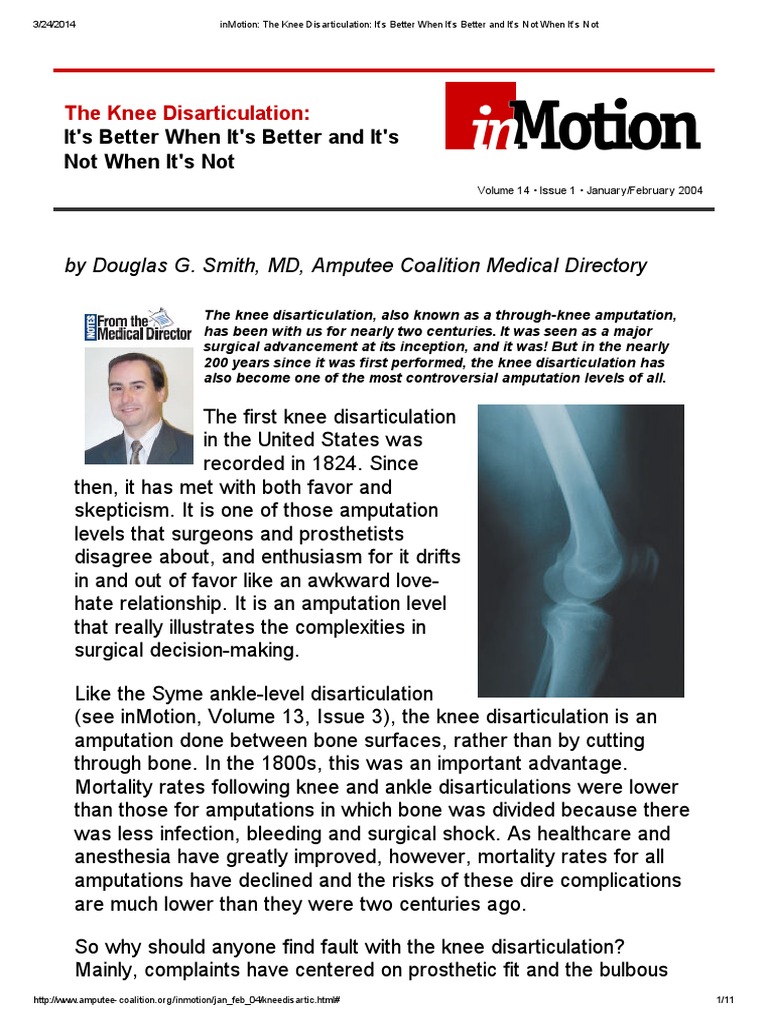 InMotion - The Knee Disarticulation - It's Better When It's Better and ...