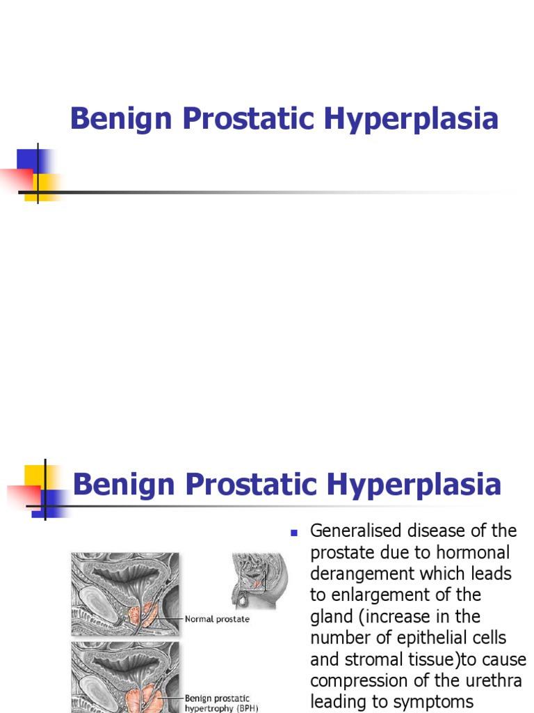 Benign Prostatic Hyperplasia | Prostate | Urology