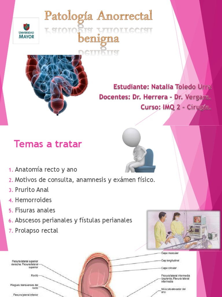 Patología Anorrectal Benigna NATALIA TOLEDO URRA - Cirugía | PDF ...