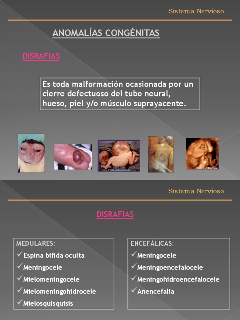 Disrrafias Espinales | PDF | Ciencia y matemáticas