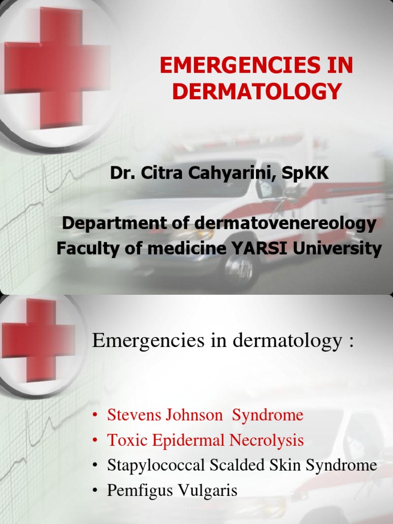 Emergencies in Dermatology: A Review of Stevens Johnson Syndrome, Toxic ...