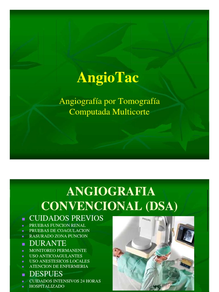 Protocolo y Aplicaciones del AngioTac | PDF | Ct Scan | Angiografía
