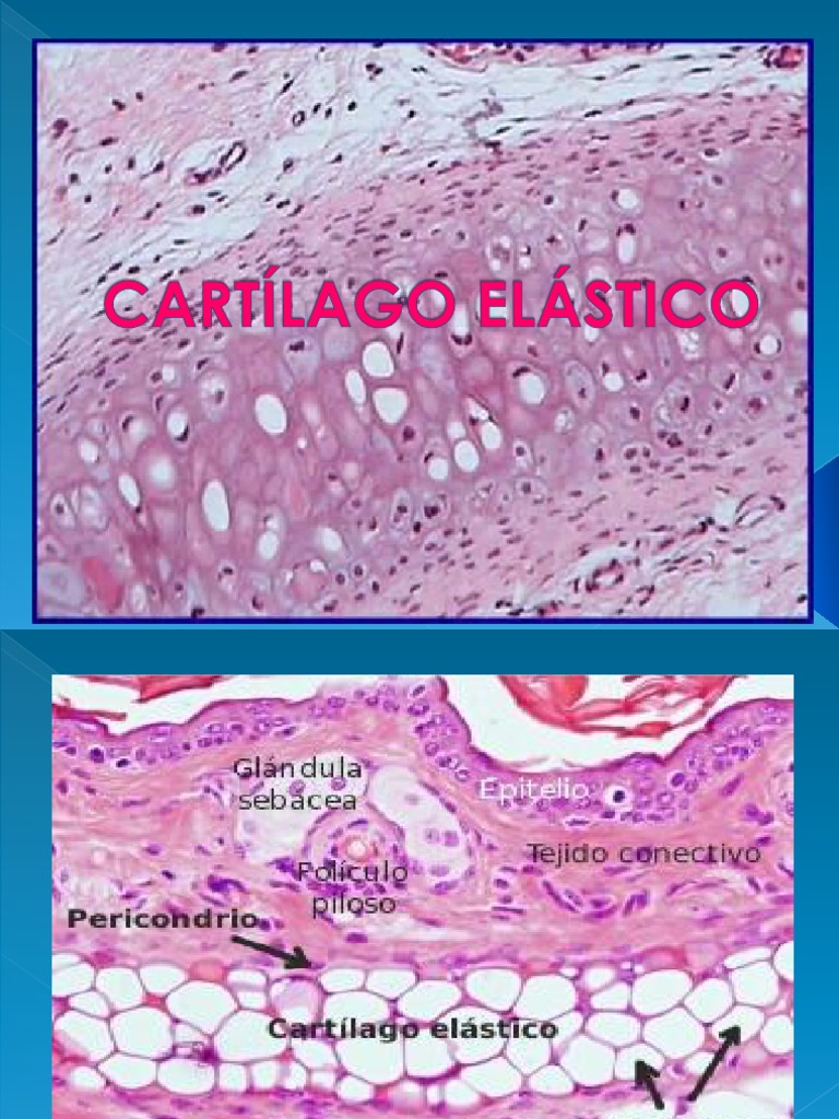 Cartílago Elástico Pdf