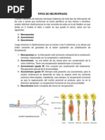 Clasificacion de Dennis | PDF | La columna vertebral | Lesión