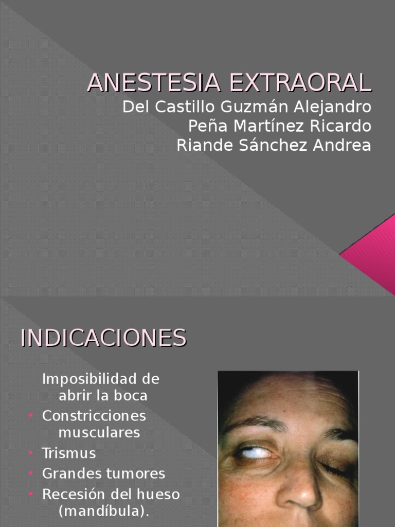 Anestesia Extraoral: Guía Técnica | PDF