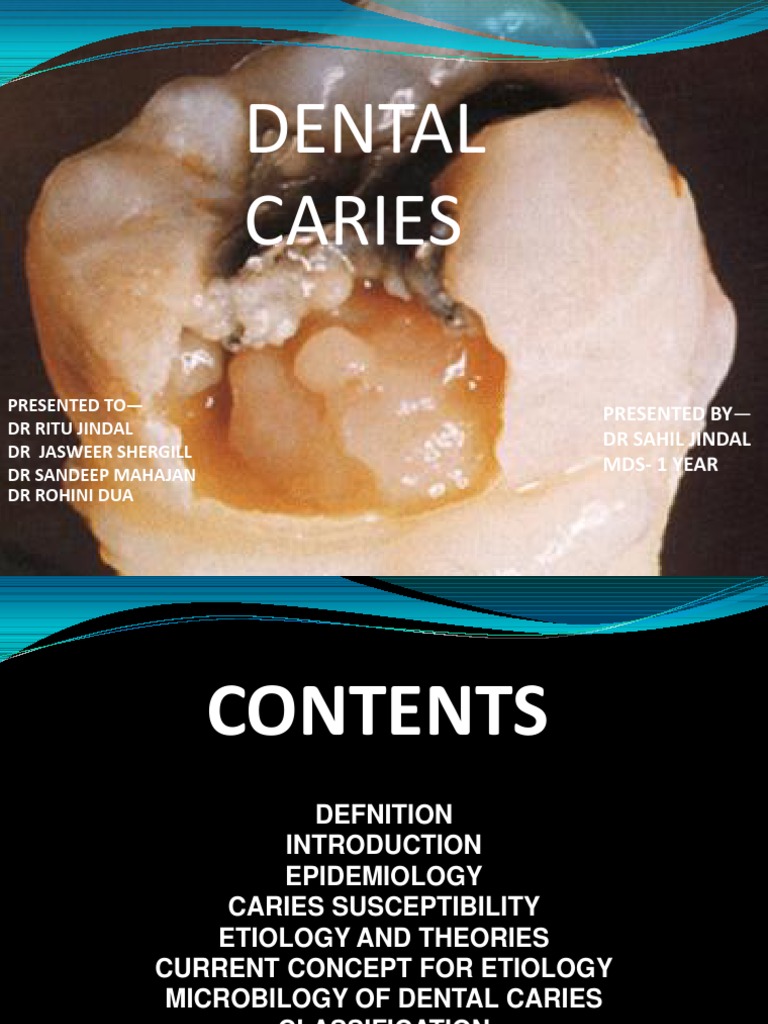 Caries PPT - ppt11 | PDF | Tooth Enamel | Dentin