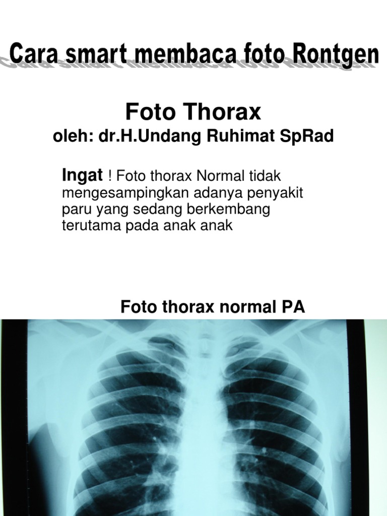 Panduan Foto Thorax Anak Normal | PDF