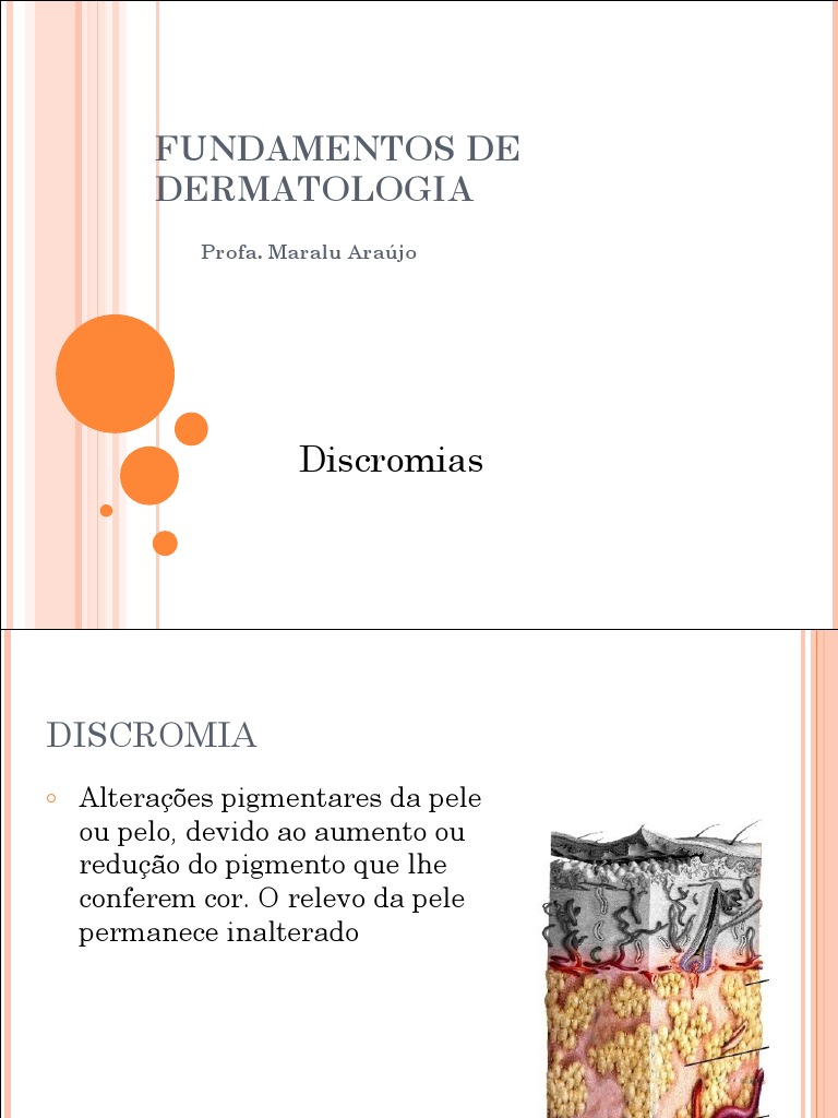 Discromias: Tipos e Causas na Pele | PDF