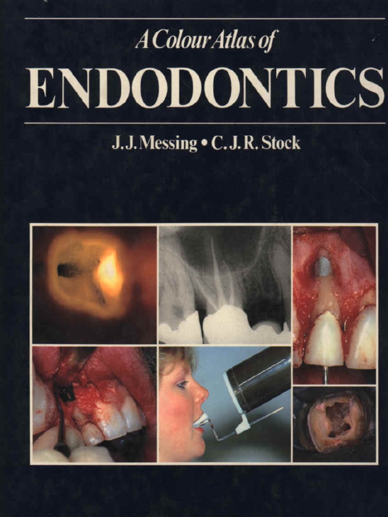A Colour Atlas of Endodontics - Messing | PDF