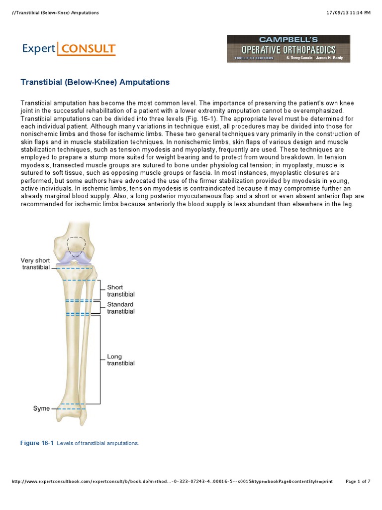 17/09/13 11:14 PM //transtibial (Below-Knee) Amputations | PDF ...