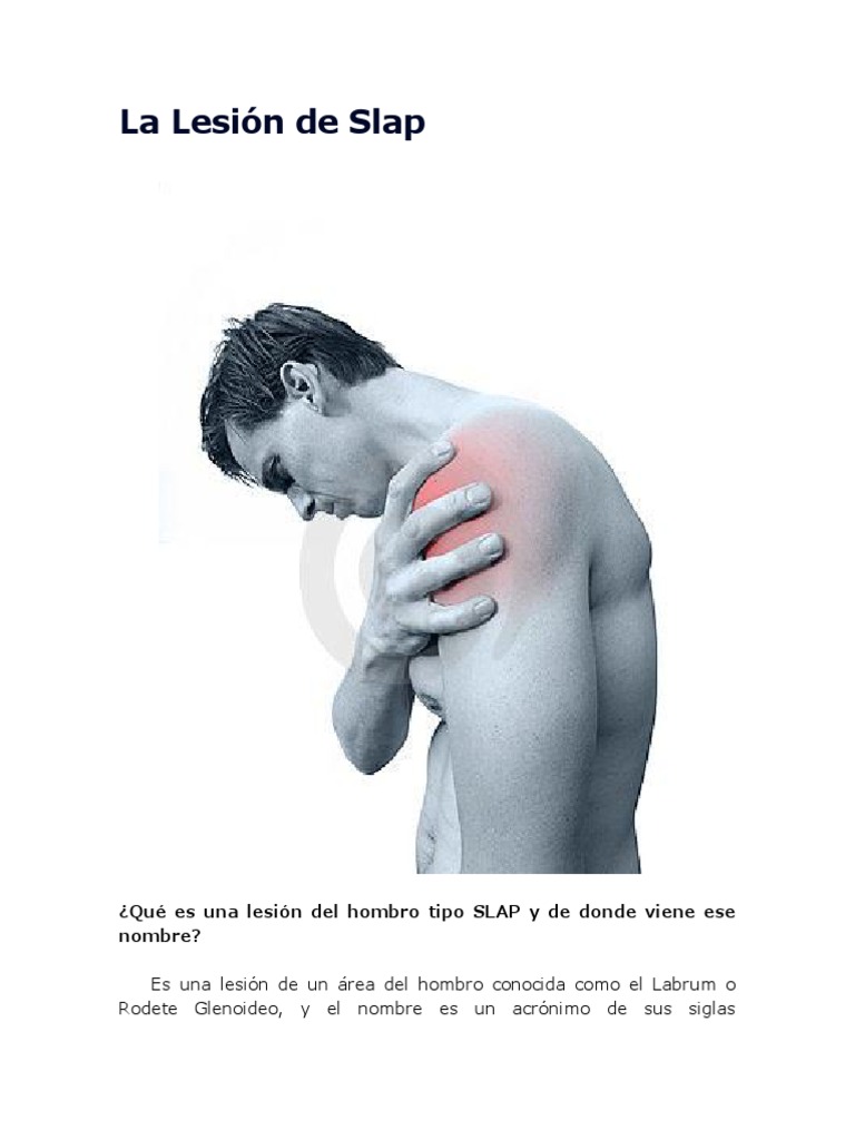 Lesión SLAP del Labrum Glenoideo | PDF | Hombro | Medicina CLINICA