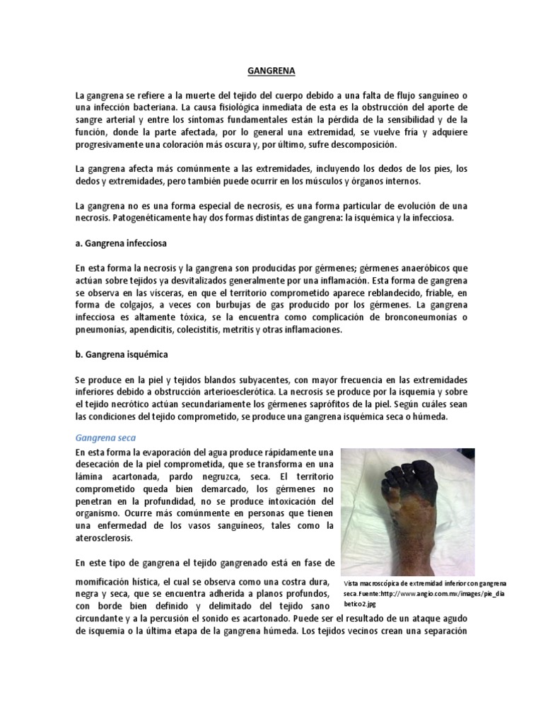 Análisis detallado de la gangrena seca a través de imágenes ...