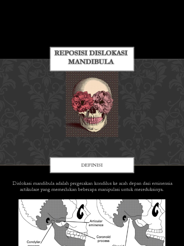 Reposisi Dislokasi Mandibula: Prosedur dan Risiko | PDF