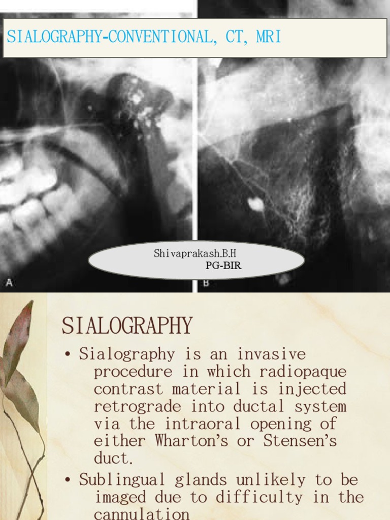 Sialography: Techniques and Indications | PDF | Medical Specialties ...