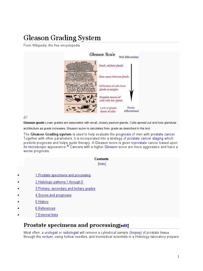 Gleason Grading System | Prostate | Earth & Life Sciences