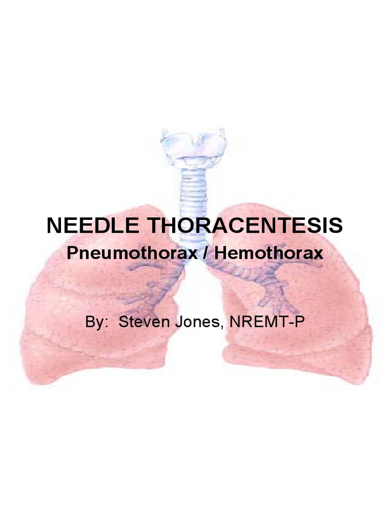 Needle Thoracentesis: A Life-Saving Procedure for Tension Pneumothorax ...